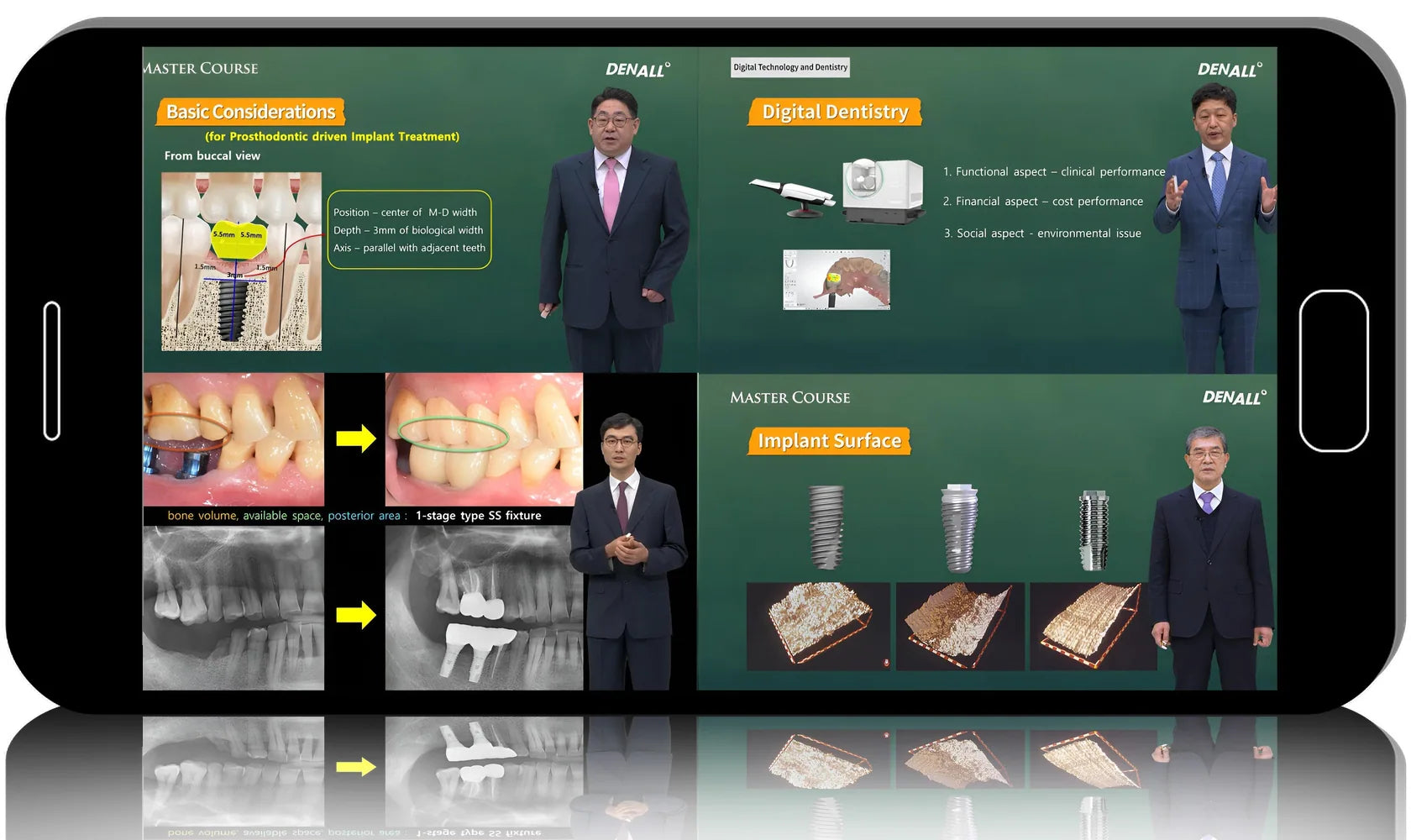 OSSTEM PROTHESE COURSE: Mastering Implant Prosthodontics & Digital Wor ...